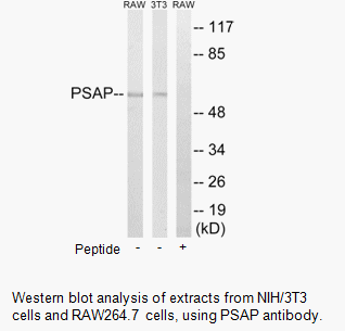 PSAP Antibody | AAT Bioquest