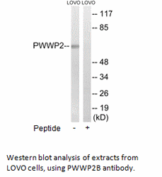 PWWP2B Antibody | AAT Bioquest