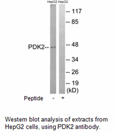 PDK2 Antibody | AAT Bioquest