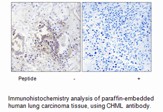 CHML Antibody | AAT Bioquest