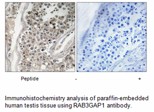 RAB3GAP1 Antibody | AAT Bioquest