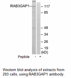 RAB3GAP1 Antibody | AAT Bioquest