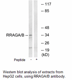 RRAGA/B Antibody | AAT Bioquest