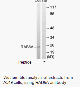 RAB6A Antibody | AAT Bioquest