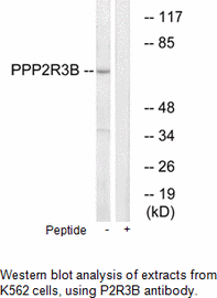 PPP2R3B Antibody | AAT Bioquest