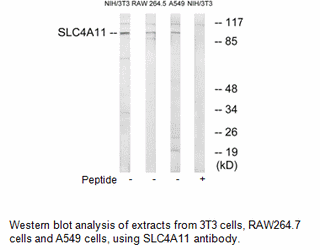 SLC4A11 Antibody | AAT Bioquest