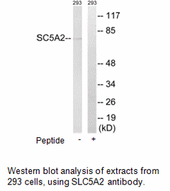 SLC5A2 Antibody | AAT Bioquest