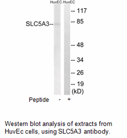 SLC5A3 Antibody | AAT Bioquest