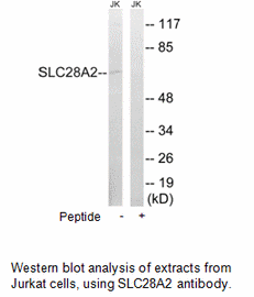 SLC28A2 Antibody | AAT Bioquest
