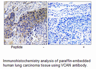 VCAN Antibody | AAT Bioquest