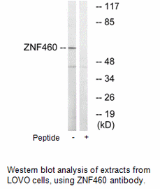 ZNF460 Antibody | AAT Bioquest