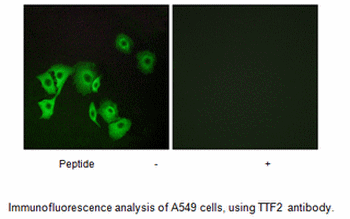 TTF2 Antibody | AAT Bioquest