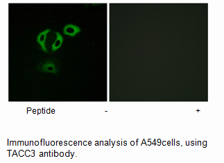 TACC3 Antibody | AAT Bioquest