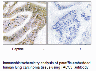 TACC3 Antibody | AAT Bioquest