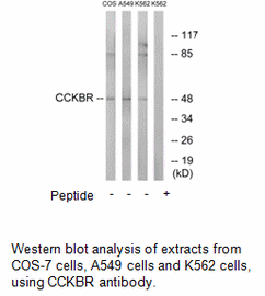 CCKBR Antibody | AAT Bioquest