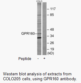 GPR160 Antibody | AAT Bioquest