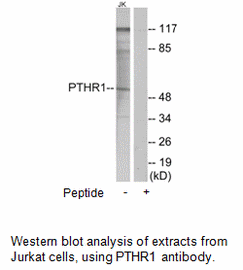 PTHR1 Antibody | AAT Bioquest