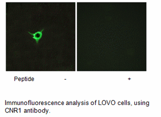 CNR1 Antibody | AAT Bioquest