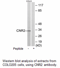 CNR2 Antibody | AAT Bioquest