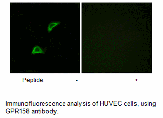 GPR158 Antibody | AAT Bioquest