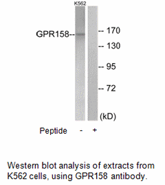 GPR158 Antibody | AAT Bioquest