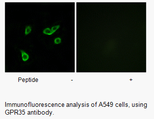 GPR35 Antibody | AAT Bioquest