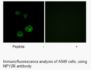 NPY2R Antibody | AAT Bioquest