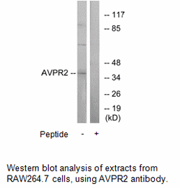 AVPR2 Antibody | AAT Bioquest