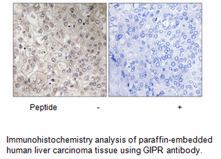 GIPR Antibody | AAT Bioquest