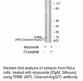 THRB (AP2,Cleaved-Arg327) Antibody | AAT Bioquest